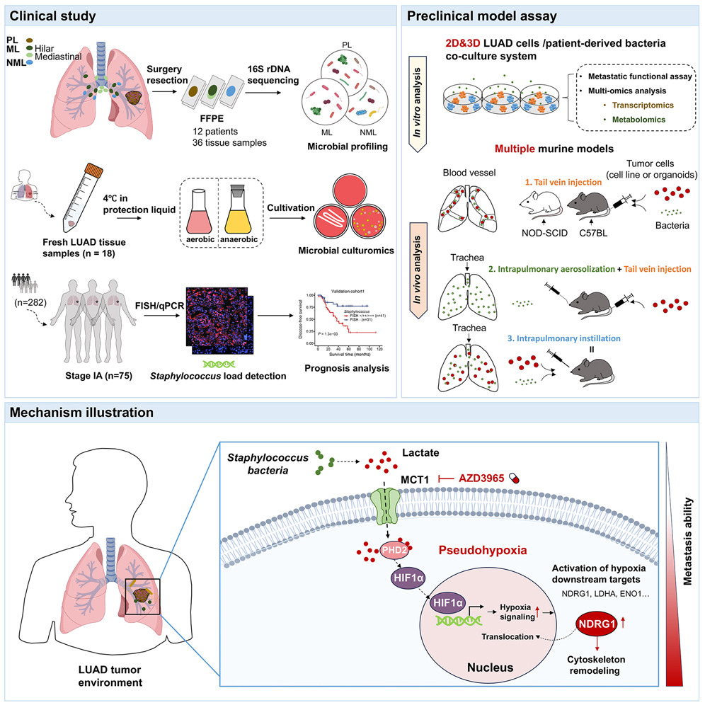 Lactate production by tumor-resident Staphylococcus promotes metastatic ...